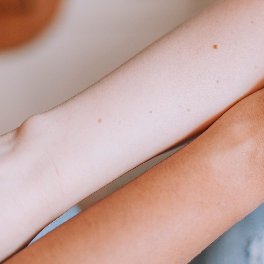 Dermont – Clínica Dermatológica